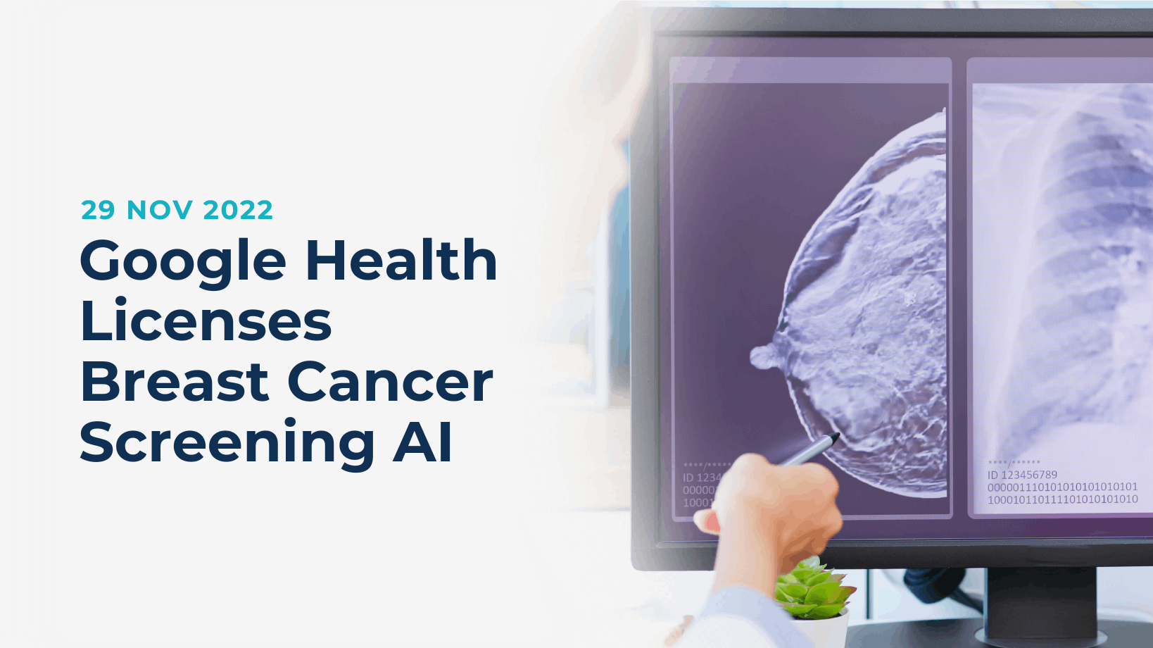Google Health Licenses Breast Cancer Screening AI to iCAD