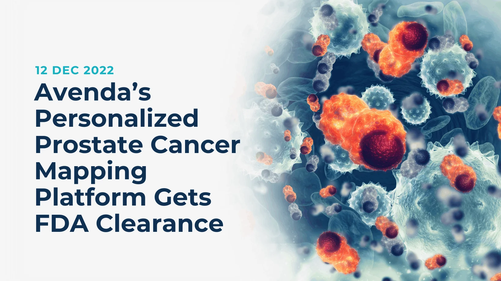 Avenda’s Platform for Personalized Prostate Cancer Mapping Earns FDA ...